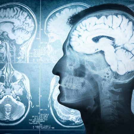 Food for Thought—Nutrients for Brain Health - Ask The Scientists